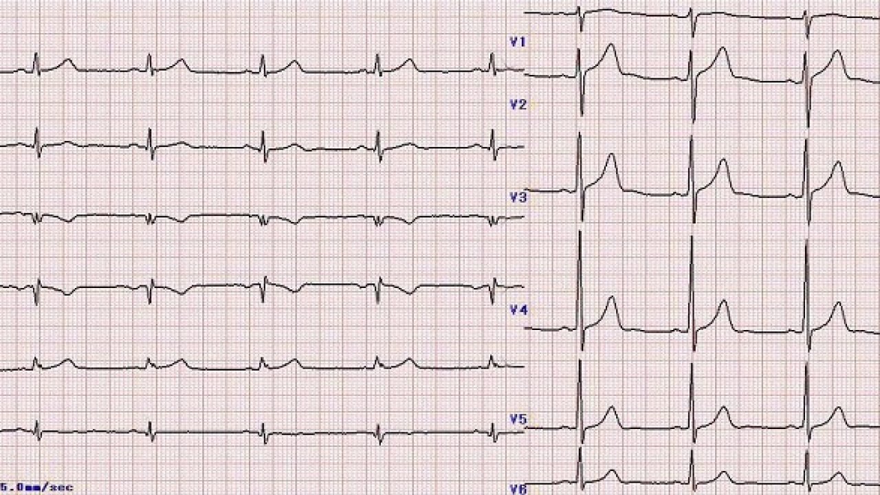Đo điện tim để làm gì? Giải đáp cùng với Tập đoàn thiết bị Y tế Việt Nhật